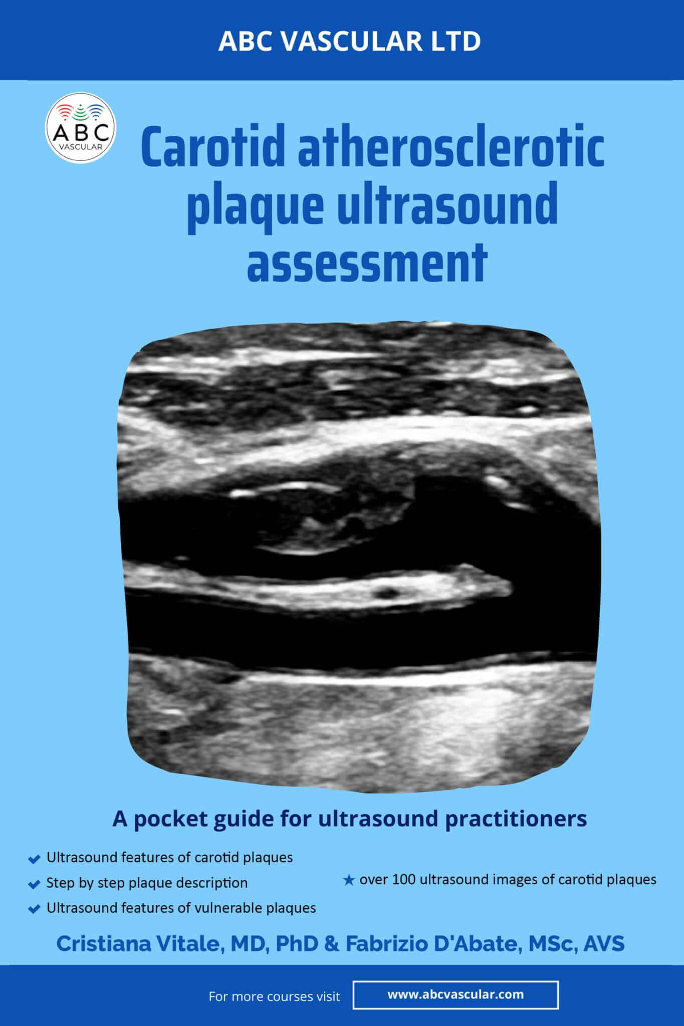 Vascular Ultrasound Book - ABC Vascular